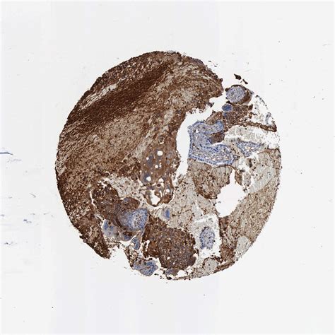Tissue Expression Of Fn1 Staining In Placenta The Human Protein Atlas