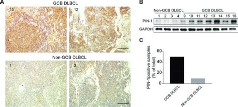 Pin 1 Expression Is Enhanced In The Gcb Subtype Of Dlbcl A