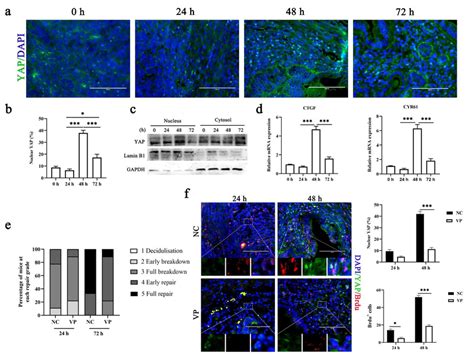 Pharmacological Inhibition Of Yap At Menses Delays Repair Ab
