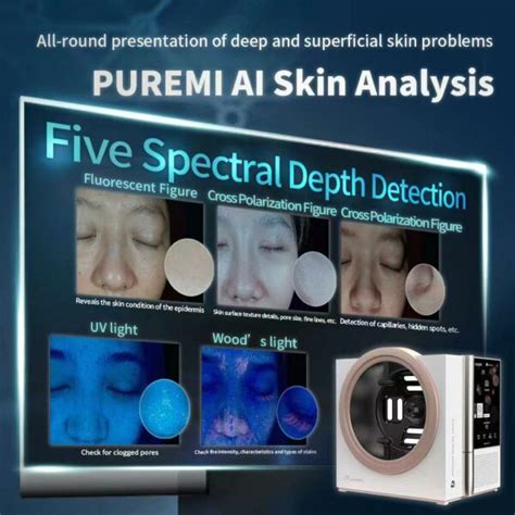 Portable 3d Ai Skin Analyzer Skinsoft