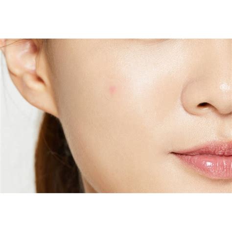 There Are 3 Types Of New Lot Cosrx Acne Pimple Master Patch Patches 3 Types Honest Bee