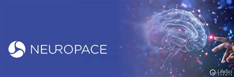 Neuropace In Person And Virtual Investor Day To Discuss Rns System In
