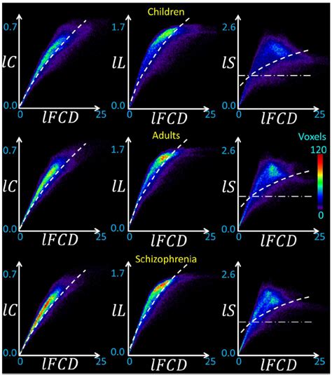 Voxelwise Association Between Graph Theory Measures Two Dimensional Download Scientific