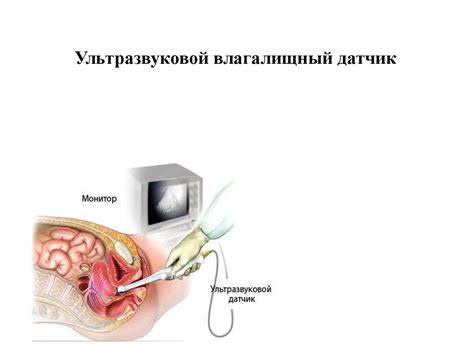 Методика обследования гинекологических больных дополнительные методы