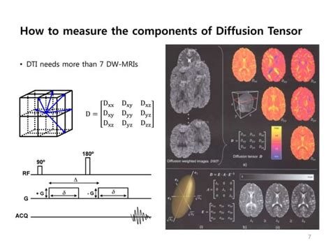 Diffusion Tensor Imaging 2011 10 04 이정원 Ppt Free Download