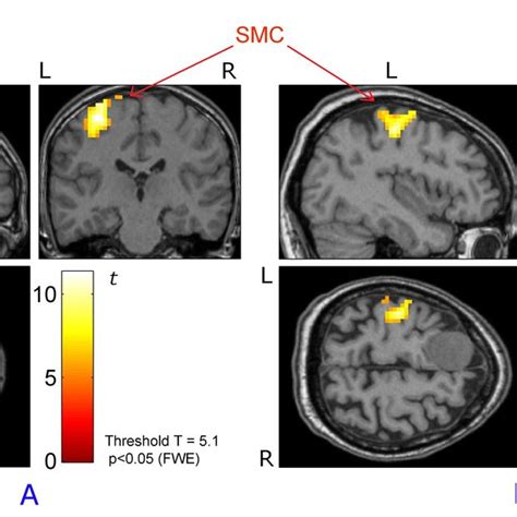 Head Motion Parameters Measured From Functional Images Download