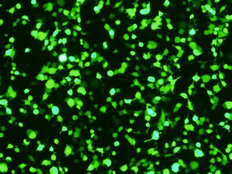 Nepa21 Sh Sy5y Human Neuroblastoma Cells Transfection Efficiency