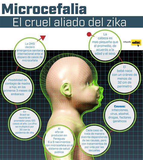 Zika Aumentan Casos De Bebés Con Microcefalia En Brasil Mundo Abc