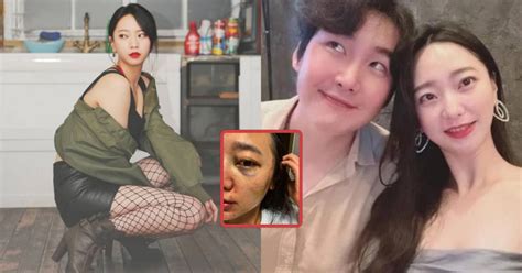 ခင်ပွန်းဖြစ်သူရဲ့ နှိပ်စက်ခြင်းကိုရက်ရက်စက်စက် ခံနေရတယ်လို့ ဝန