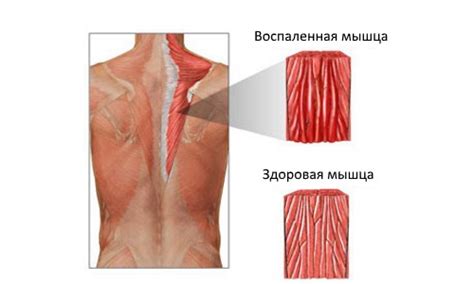 Лошадиный Бальзам: инструкция и показания по применению, состав, цена ...