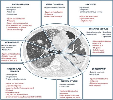 Differential Diagnosis Chest Ct Diagnostic Imaging Radiology Medical Radiography