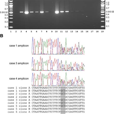 Detection By Pcr Of Atp Synthase Subunit γ Sequences Diagnostic Of T Download Scientific