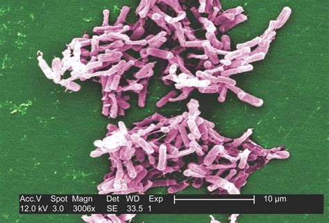 Dealing With Clostridioides Difficile Clinical Lab Products