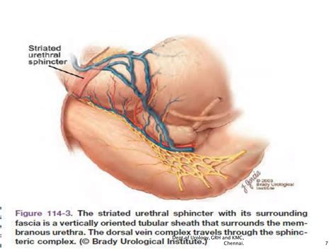 Prostate Carinoma Surgery Open Radical Retropubic Prostatectomy Rrp Pdf
