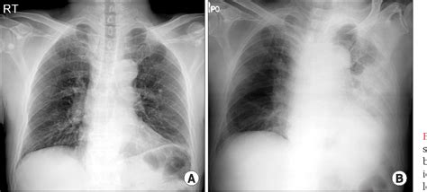 Trichoderma Cornu Damae Semantic Scholar