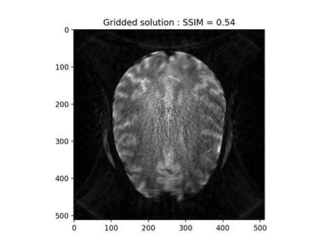 Gpu Non Cartesian 2d Reconstruction Undecimated Wavelet — Pysap V021