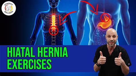 Best Exercises For Hiatal Hernia Patients Hernia Exercises Hiatal Sexiezpix Web Porn