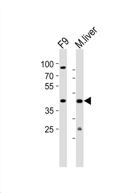 Mouse Ubtfl1 Antibody Center Purified Rabbit Polyclonal Antibody