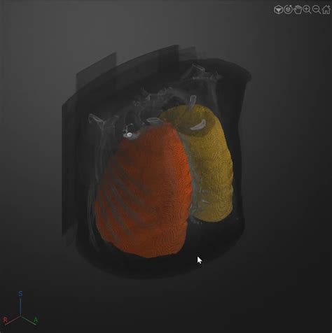 Deeplearning Ai Medicalimaging Matlab Mathworks Lizandro Oliveira