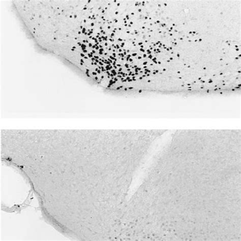 Representative Photomicrograph 20 ϫ Magnification Of Pr Ir Cells In