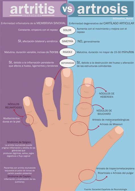Mi Peque Os Aportes Artritis Vs Artrosis Infografia