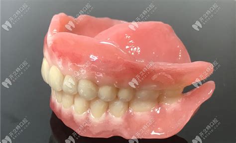 吸附性义齿真的那么好吗确实好吸附性义齿吸附性强且舒适 行业资讯 开立特口腔