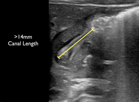 Abdominal Ultrasound Made Easy Step By Step Guide Diagnostic Medical