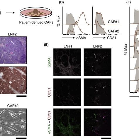 Establishment Of Cancer‐associated Fibroblasts Caf From Primary