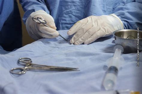 Vasectomía Sin Bisturí Gratis En Puebla 2022