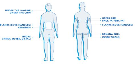Coolsculpting Areas What Areas Can Coolsculpting Treat