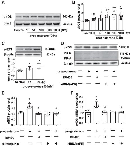 Progesterone Promotes Endothelial Nitric Oxide Synthase Expression Through Enhancing Nuclear