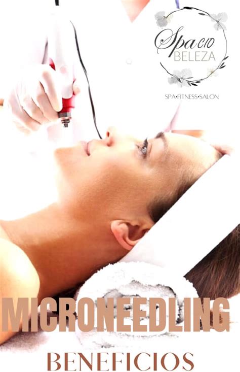 Spacio Beleza Los Beneficios Del Microneedling 1