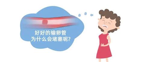 为什么输卵管堵塞会找上你