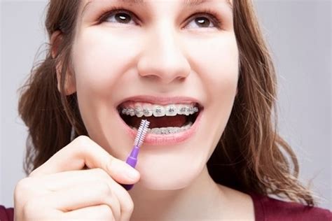 Css Teen Cleaning Braces With Proxy Brush Resized Valley View Dental