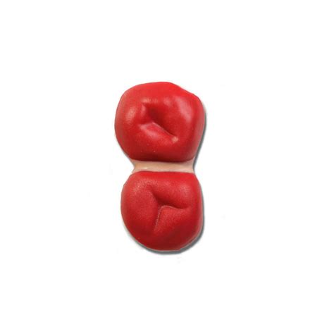 Double Barrel Ileostomy