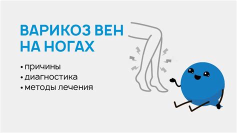Варикоз вен на ногах Youtube