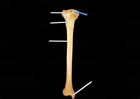 Right Tibia Flashcards Quizlet