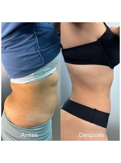 Lipolax Abdomen Y Espalda Magnética