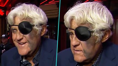 Jay Leno Shocks Fans With Eye Patch And Massive Face Bruise After Falling