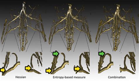 Comparison Of The Hessian Based Left And Entropy Based Middle