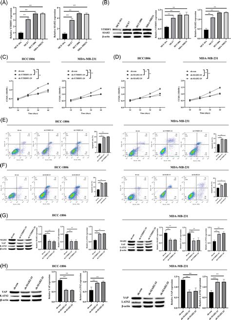 Ythdf1 Enhances Stemness And Chemoresistance In Triple‐negative Breast Cancer Cells By