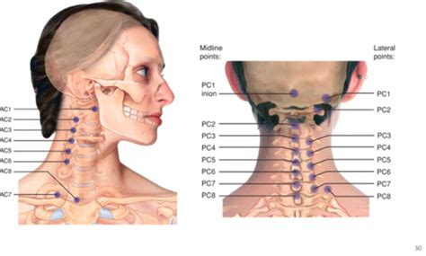 OMM L7 Cervical Spine Counterstrain Flashcards Quizlet