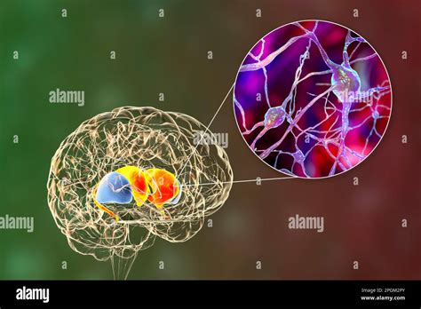 Coronal Section Brain Hi Res Stock Photography And Images Alamy