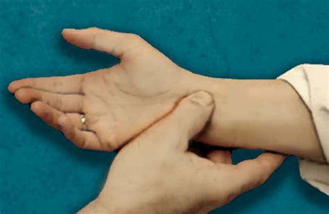 Median Nerve Compression Durkans Test Hand Surgery Source