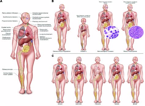 Central Illustration A Main Clinical And Radiographic Findings In Download Scientific
