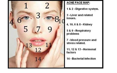 10 Causes And Simple Remedies For Pimples On Forehead Pimples On