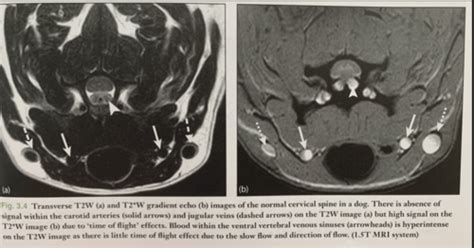 Neuroradiology Mri Artifacts Flashcards Quizlet