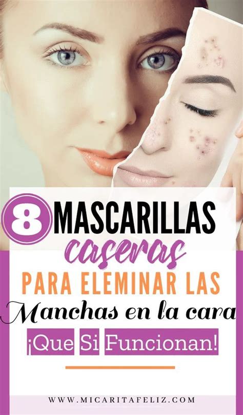 Receta Para Limpiar Manchas Marrones De La Cara Artofit