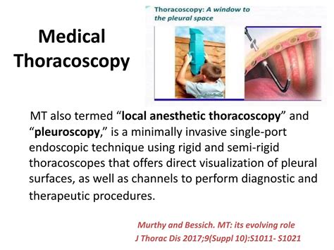 Medical Thoracoscopy2022 Pptx