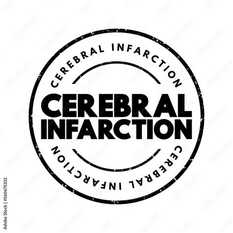 Cerebral Infarction Pathologic Process That Results In An Area Of